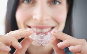 When Do You Need a Mouthguard?